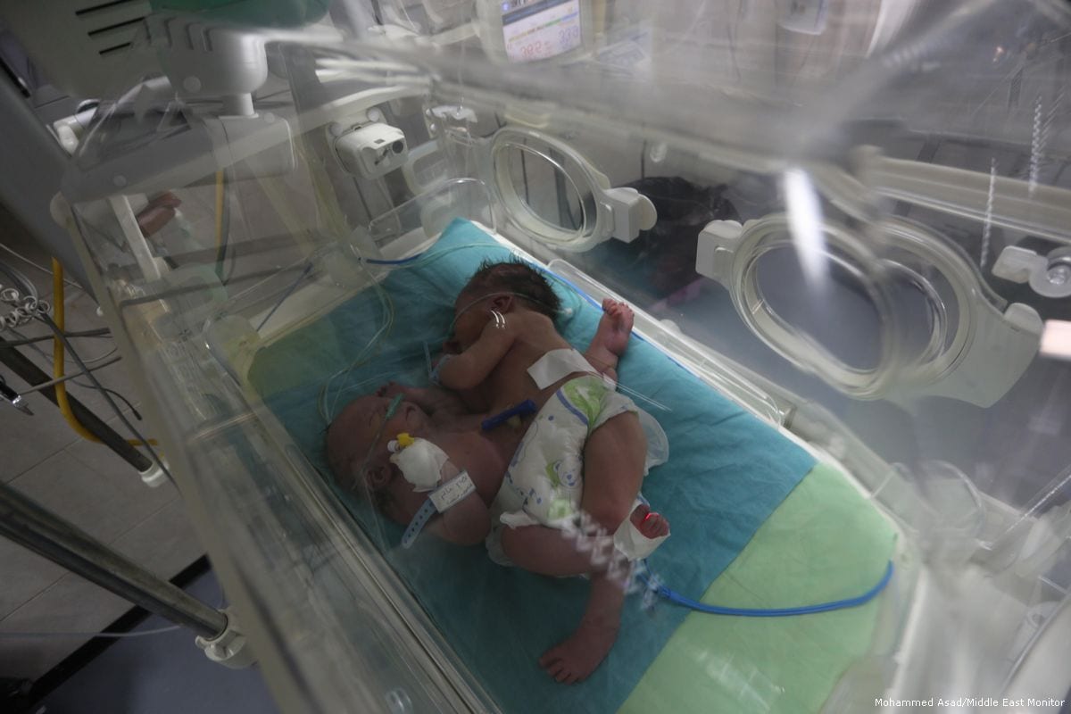 Palestinian gives birth to conjoined twins in Gaza – Middle East Monitor