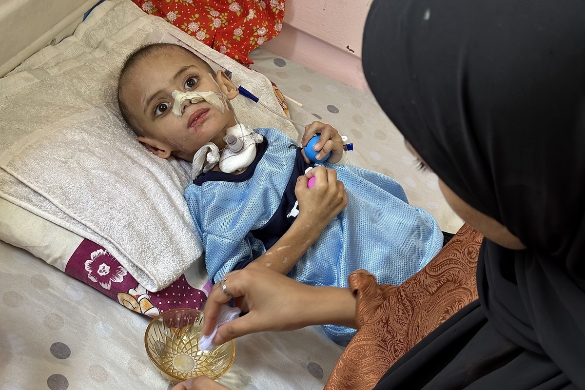 3-year-old Omar battles for life after losing family in Gaza strikes ...