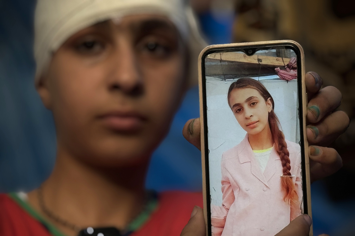 Palestinian girl Hala wait for treatment to regain her hair after ...