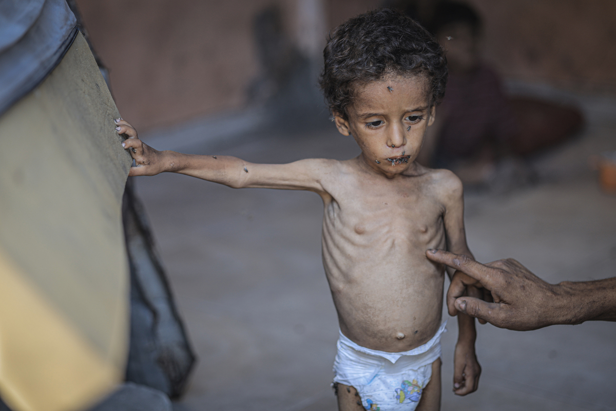 Malnutrition crisis deepens for children in Gaza under Israeli blockade ...