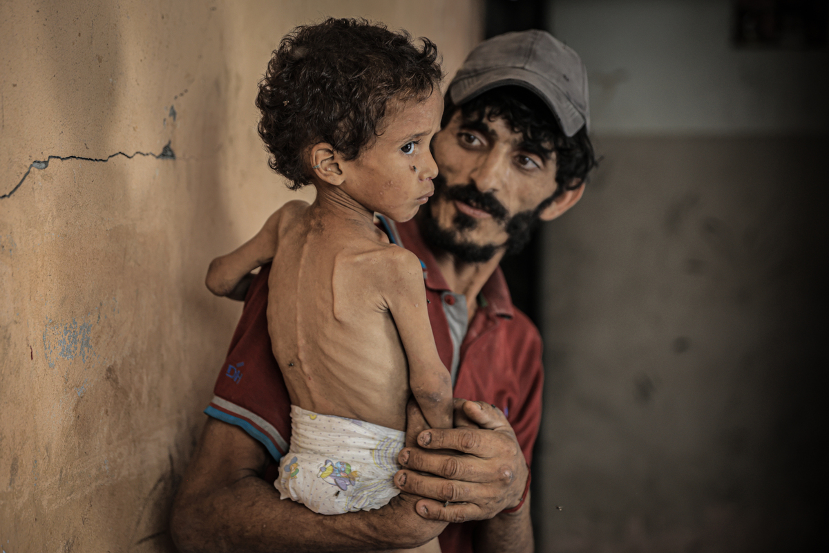 Malnutrition crisis deepens for children in Gaza under Israeli blockade ...