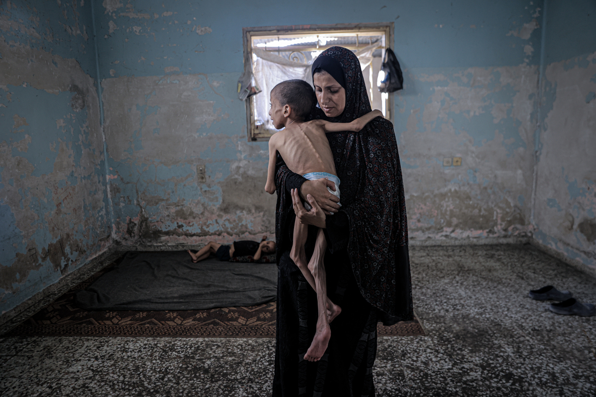 10-year-old Nafez fight malnutrition and brain atrophy as hunger crisis ...