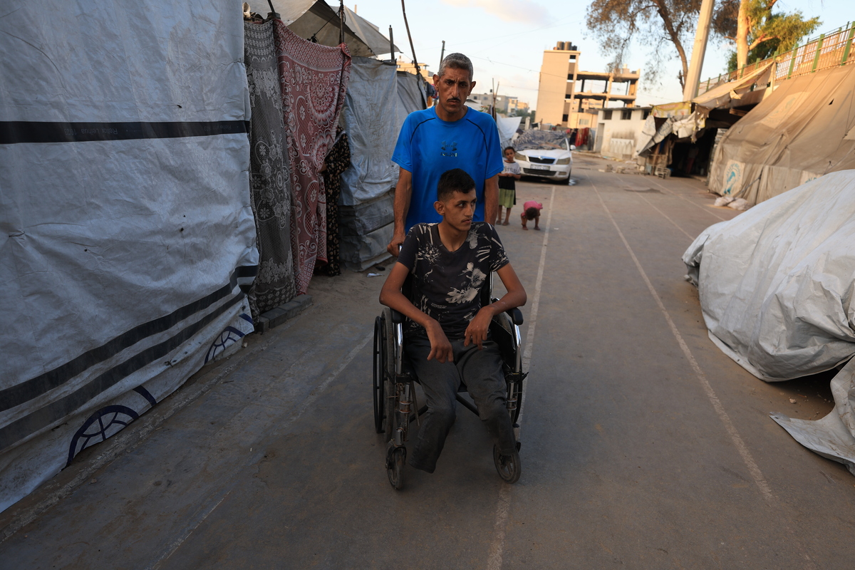 Palestinian Siblings await prosthetics after losing limbs in Israeli ...