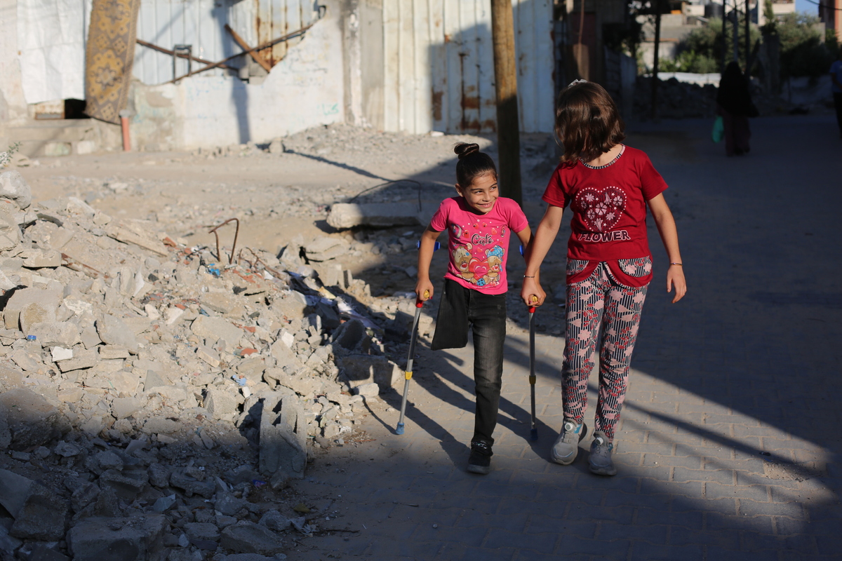 9-year-old Gaza child awaiting prosthetics after losing one leg in ...