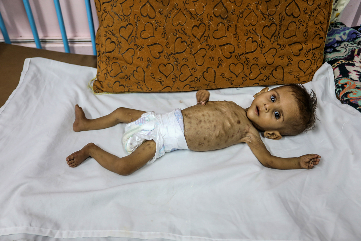 Babies in Gaza struggles with hunger – Middle East Monitor