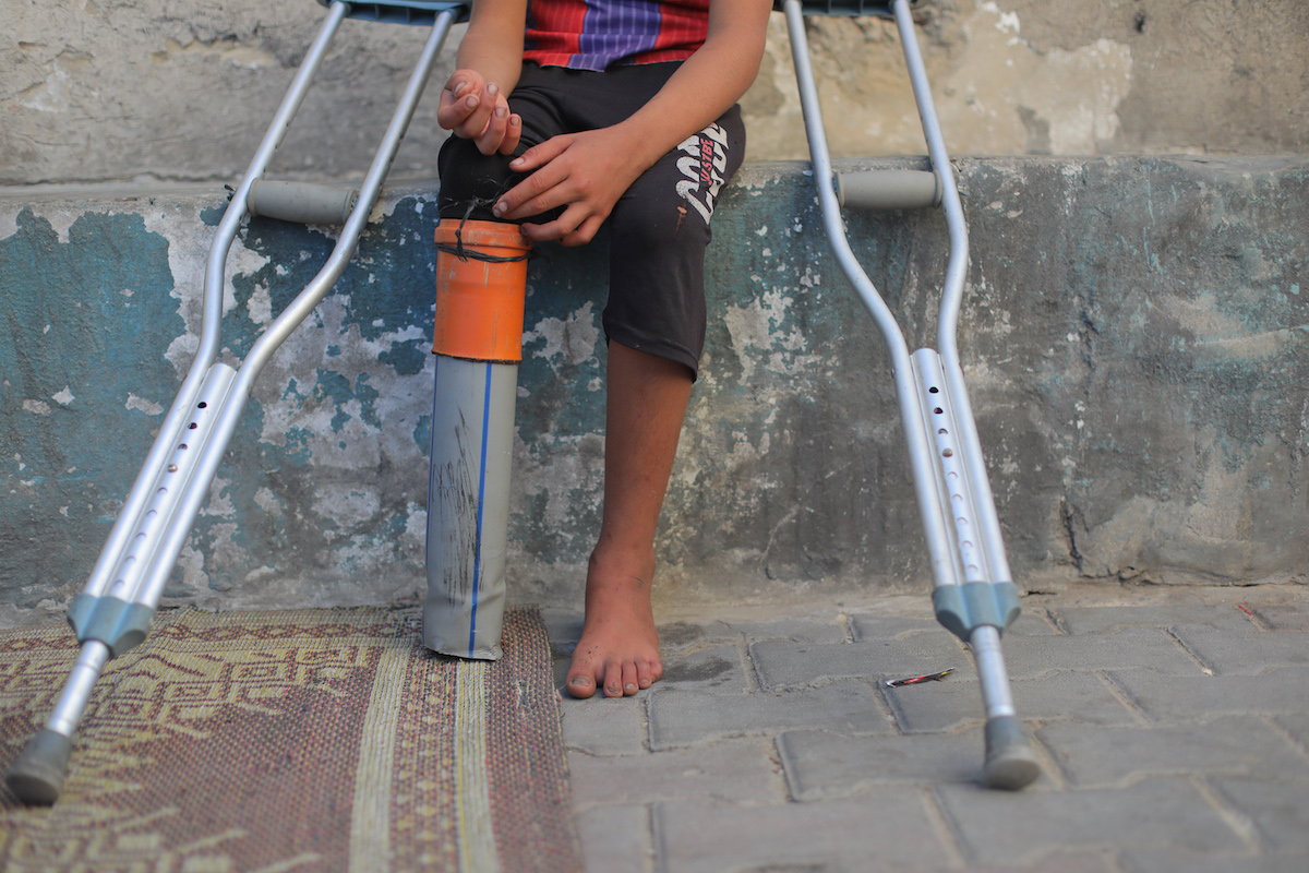 Gaza now has world’s highest child amputation rate, health ministry ...