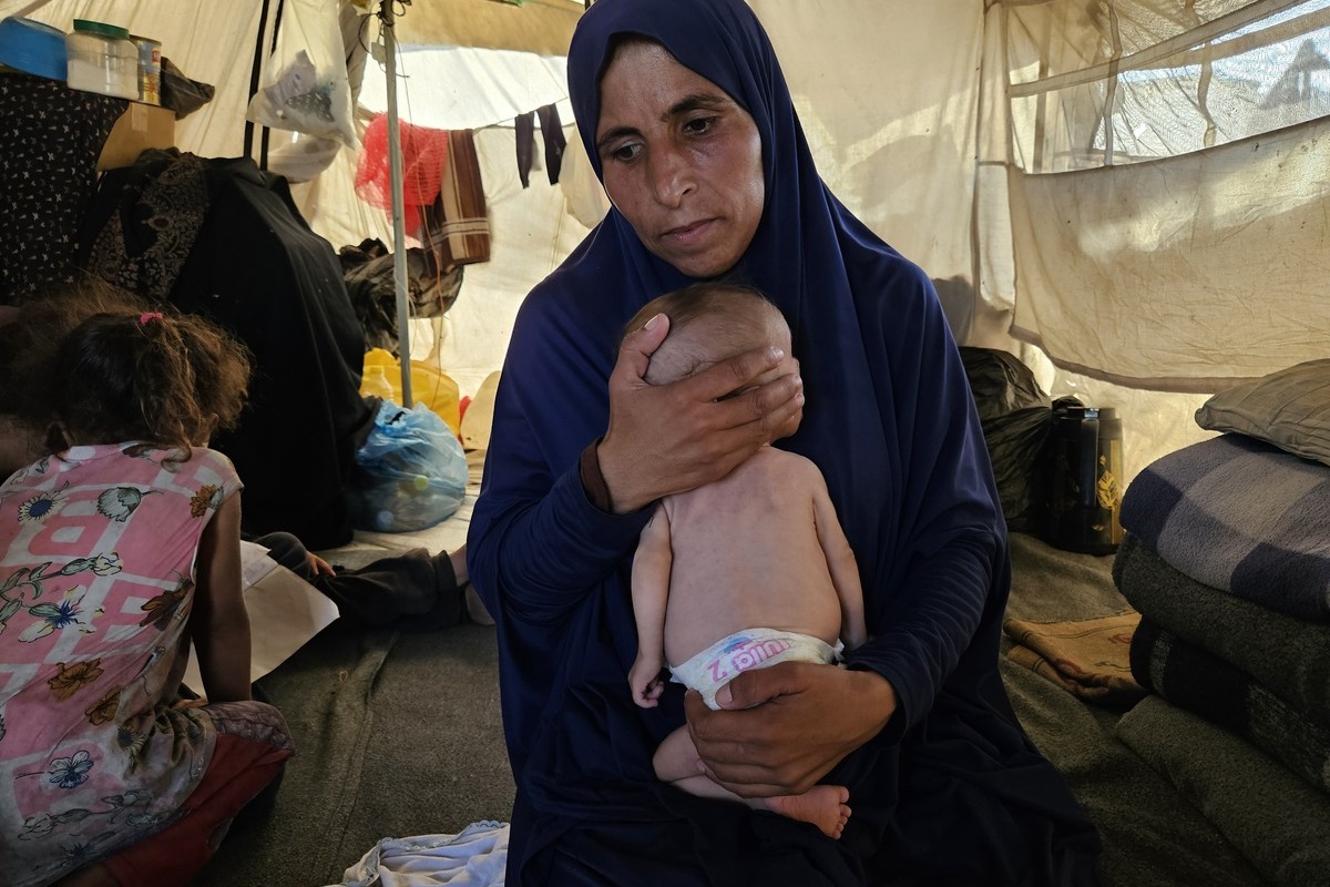 4-month-old Palestinian baby is in critical condition due to a hole in ...