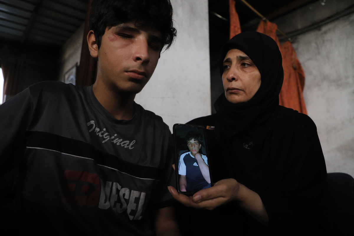 Gazan child loses eyesight in Israeli attack, faces lack of treatment ...