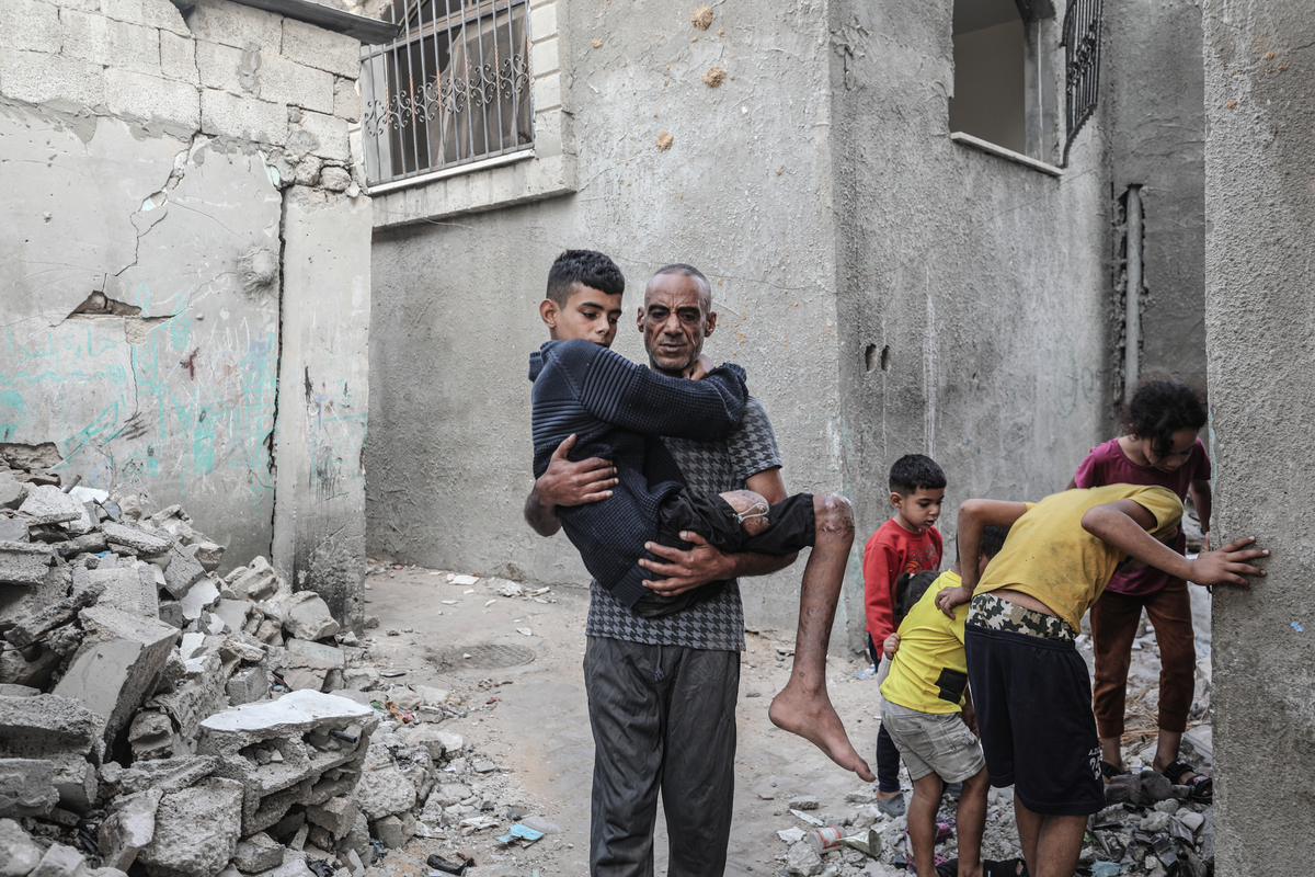 14-year-old boy in Gaza who lost one leg, is now at risk of losing the ...