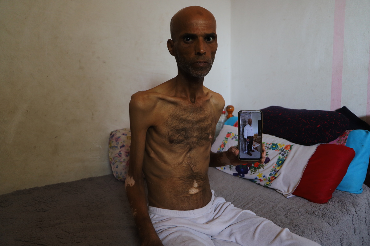 Gazan man weighing 35kg battles malnutrition and anemia – Middle East ...
